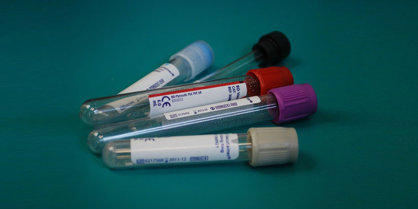 The importance of advanced lipoprotein testing - Kay Spears